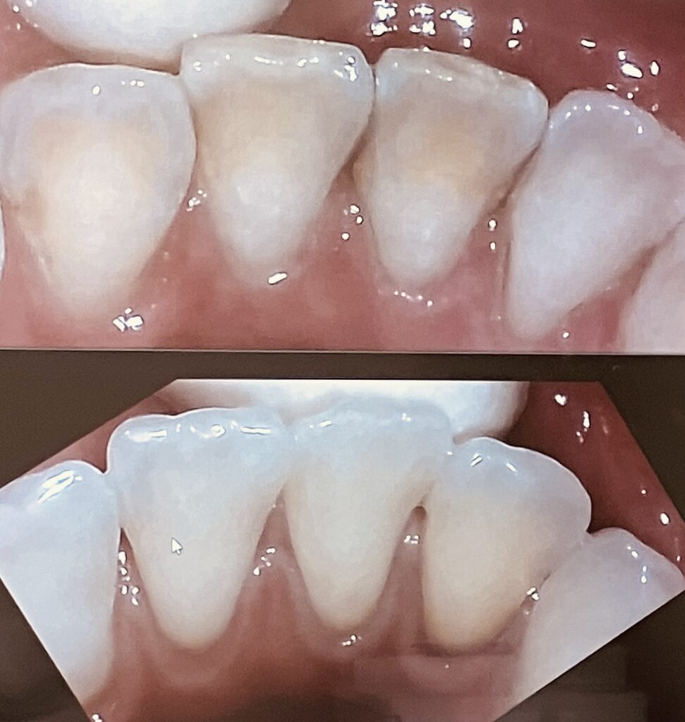 PMTC｜麹町の歯医者｜MYデンタルオフィス麹町